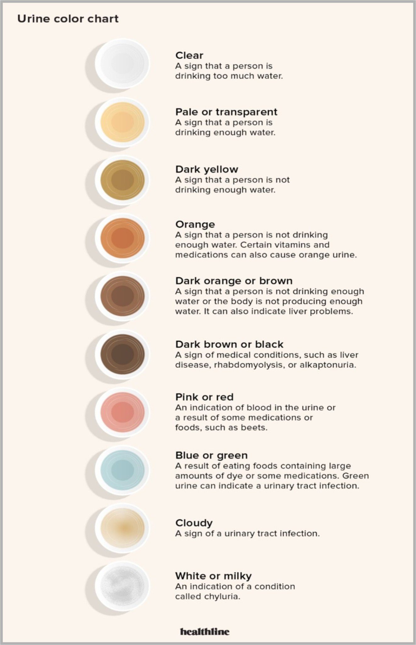 Urine Colour